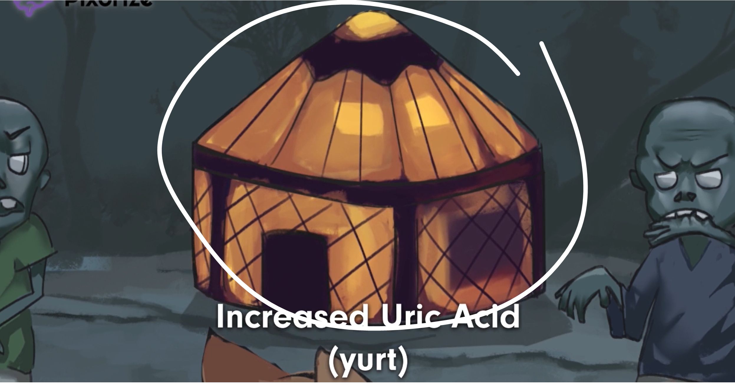 Extra Defects in HGPRT lead to poor purine salvage --> results in ...