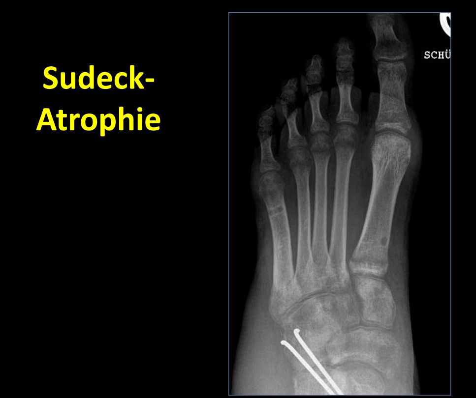 Tags #s8::Radiologie