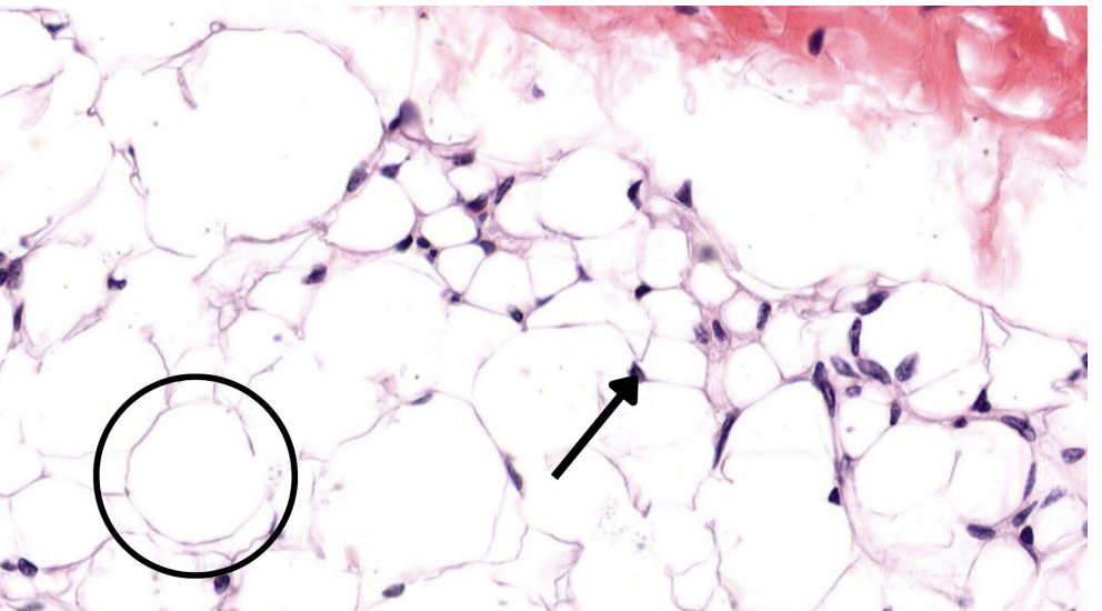 Front what is the type of cell