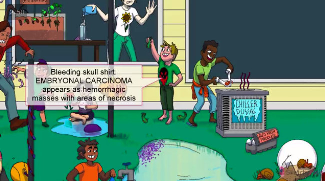 Extra Q32 Describe (1 adjective) histology of cells of embryonal carcinoma