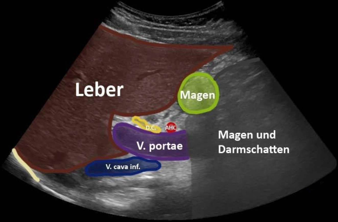 Erkennbare Strukturen (Schall)