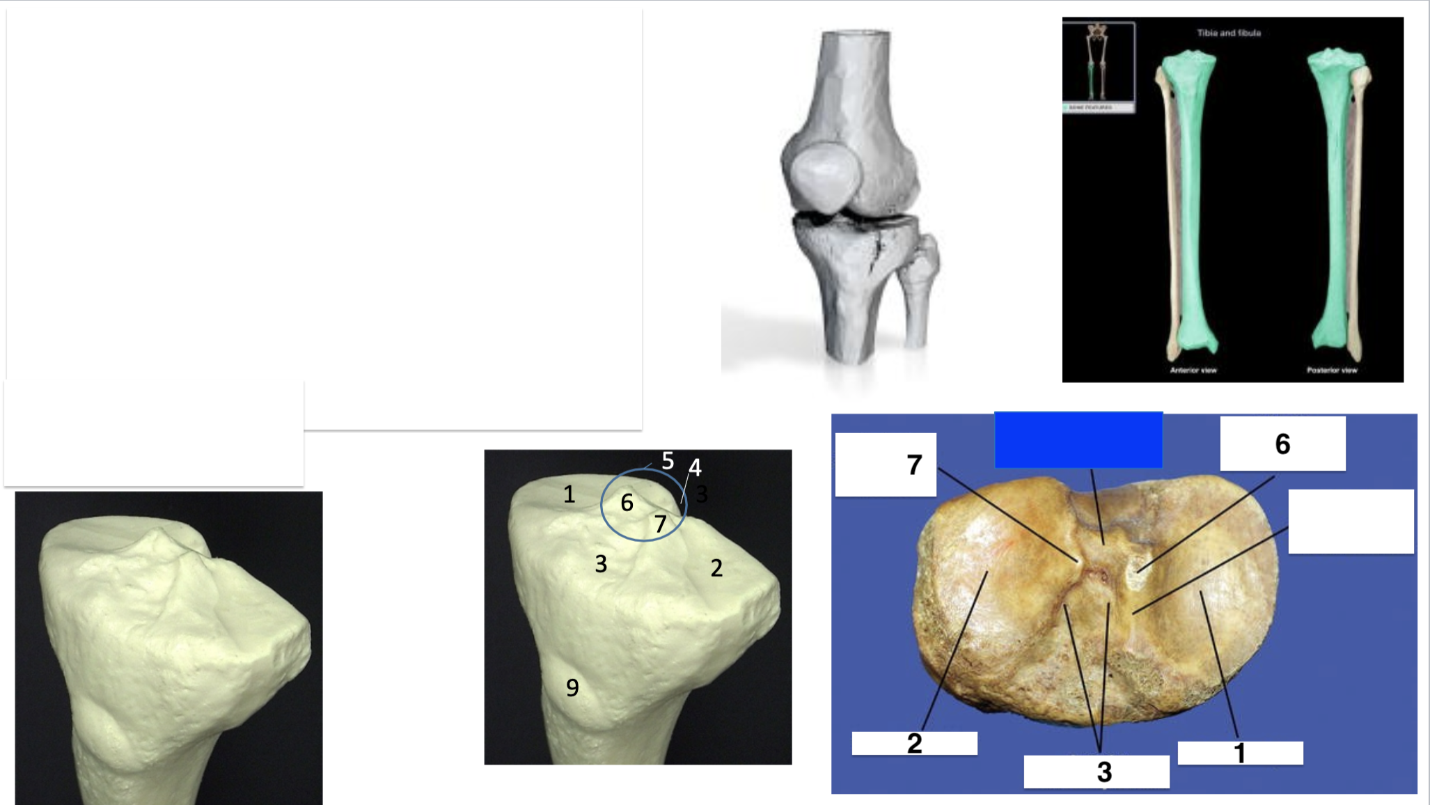 Front Name this part of the tibia. The non-articular region on the ...