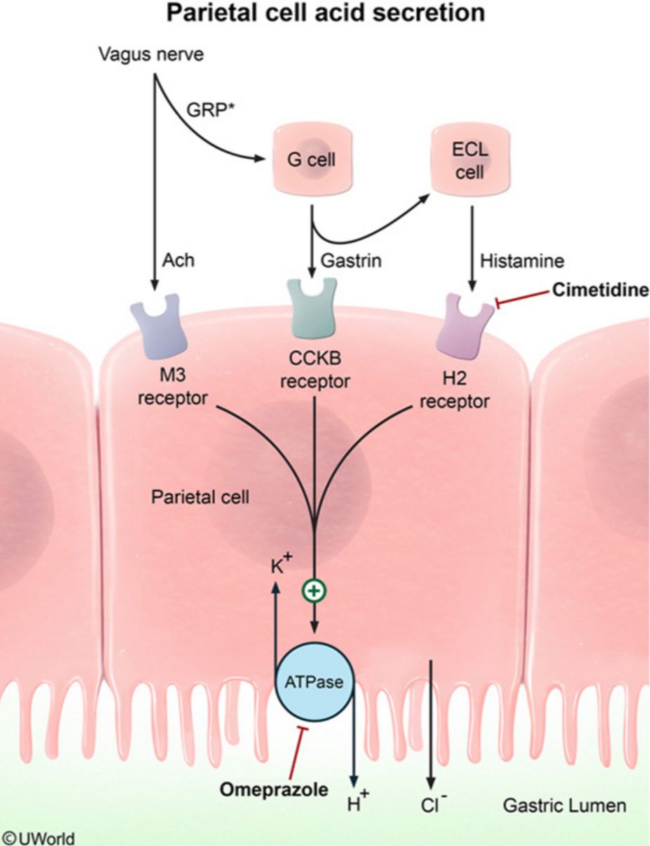 Other than Zollinger-Ellison syndrome, what neoplasm can cause gastric ...
