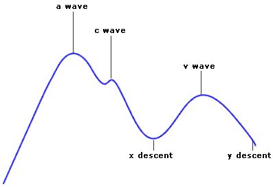 Front Explain each of these 5 points in the jugular wave form: