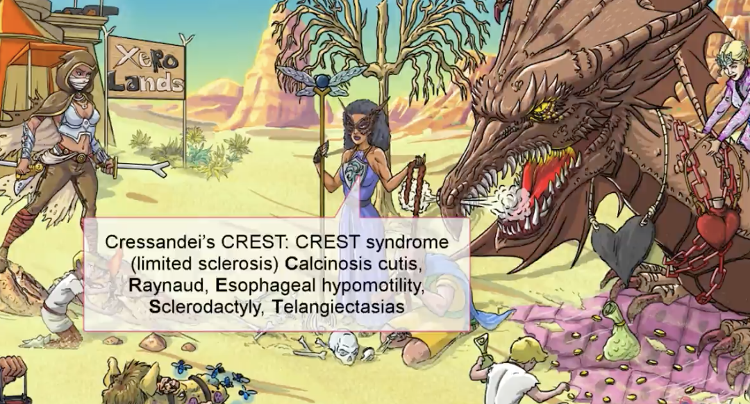 Extra Q17 What finding is seen on skin biopsy of systemic sclerosis?