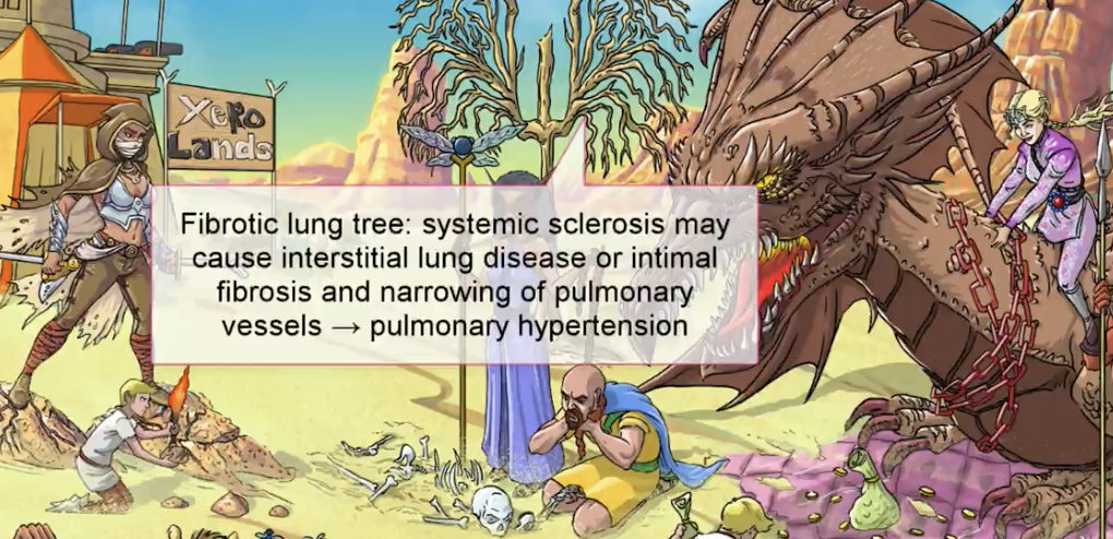 Extra Q19 What disease shares features of many autoimmune disorders ...