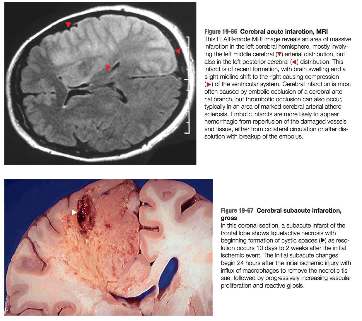 Additional Resources Atlas: