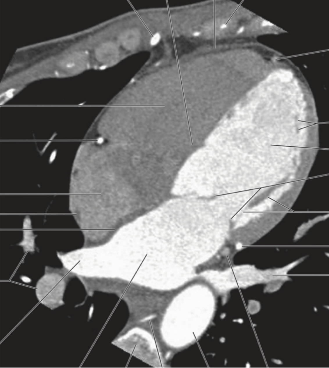 Front cardiac CT