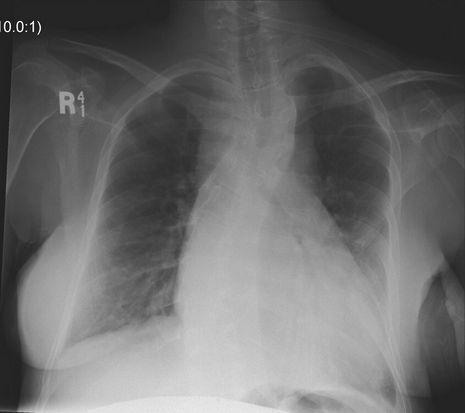 RadCases Emergency Radiology