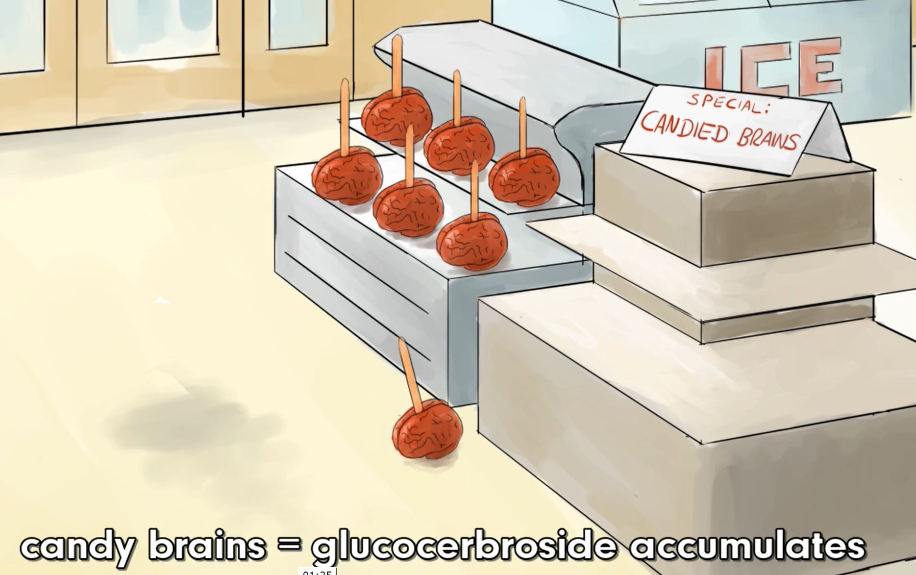 Extra Enzyme deficiency = glucocerebrosidase