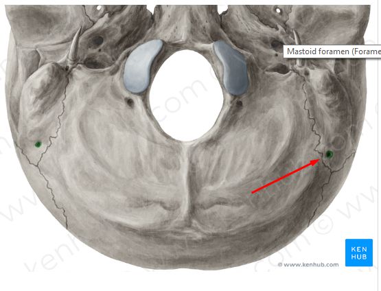 Text {{c1::foramen mastoideum}}