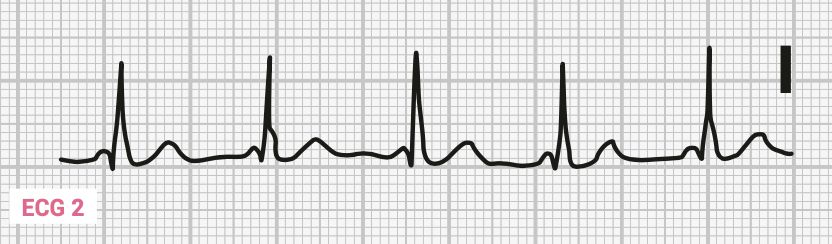 Back 1.3 mVLearn more with Medmastery