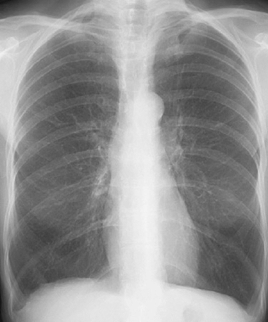 CXR Practice Deck -- Radiopaedia