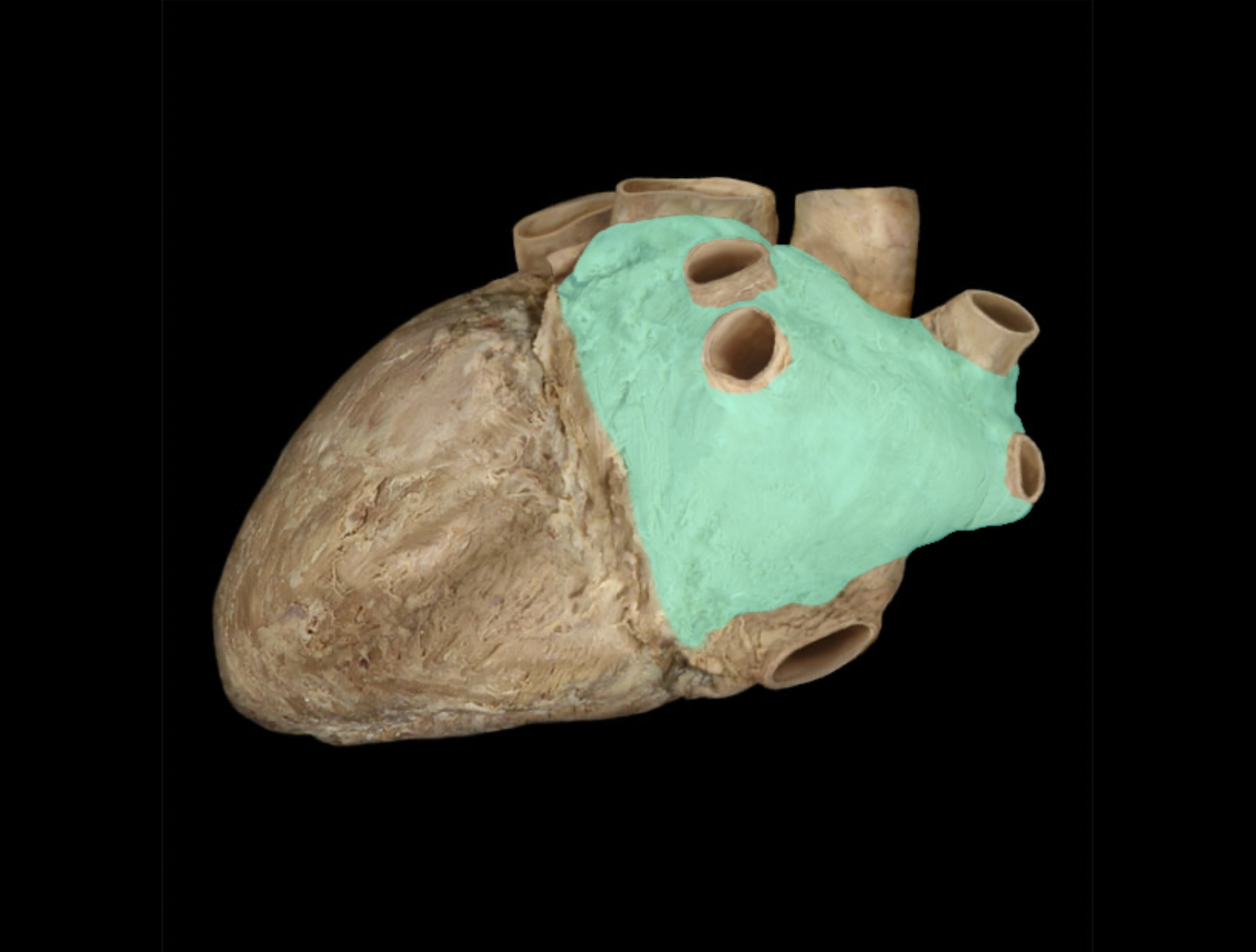 Back Left atrium