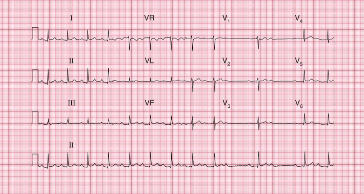 150 Cases in ECG Interpretation" (5th Edition)