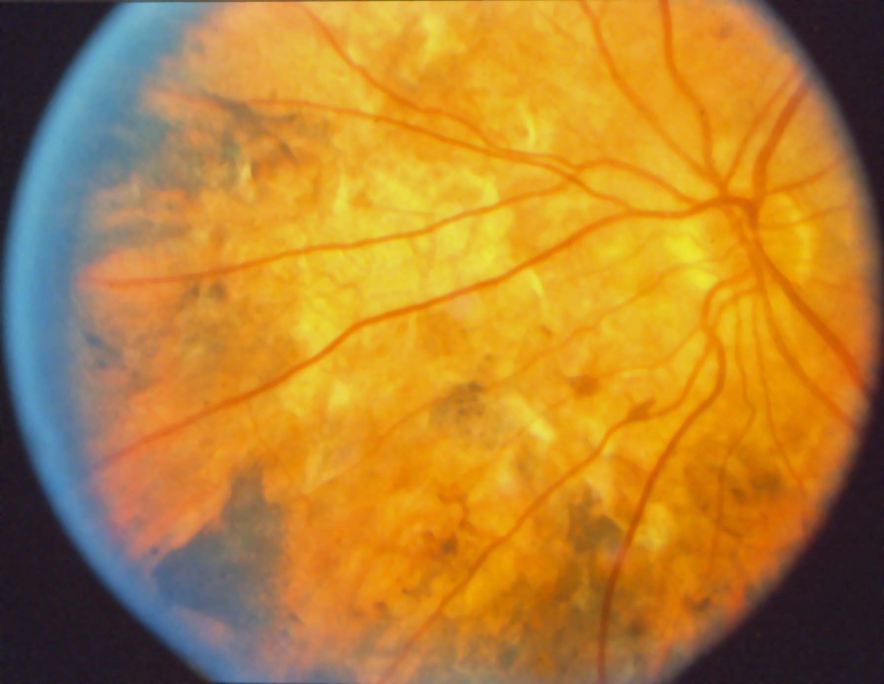 Fundus