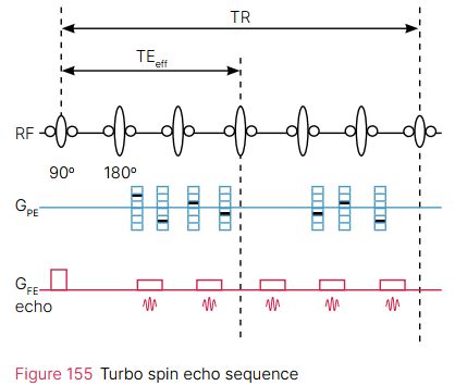 Front Turbo Spin Echo (TSE) Sequence