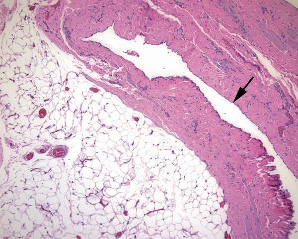 Front Diagnosis? Arrow?