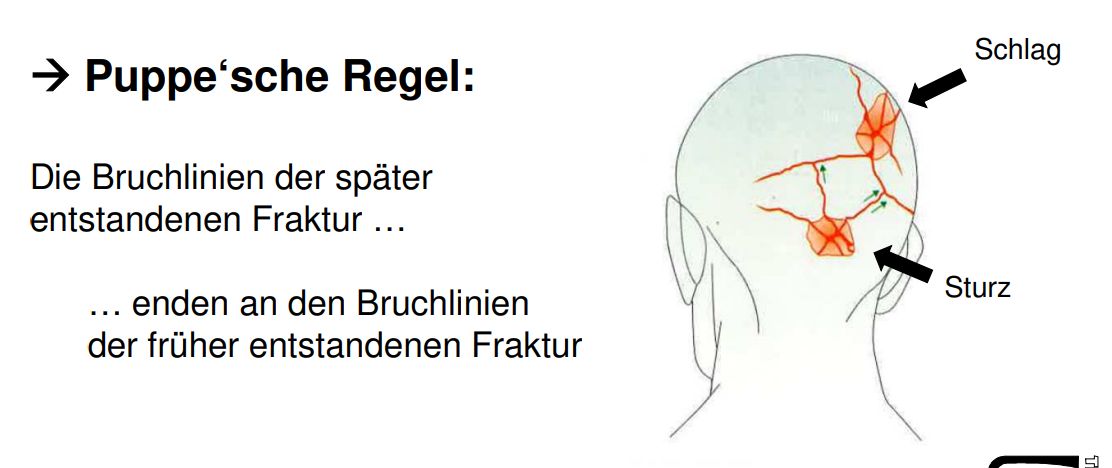 Tags #s8::Gerichtsmedizin