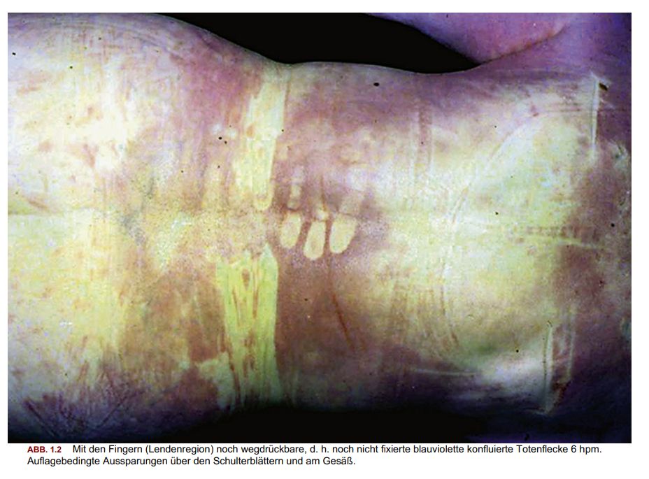 Tags #s8::Gerichtsmedizin