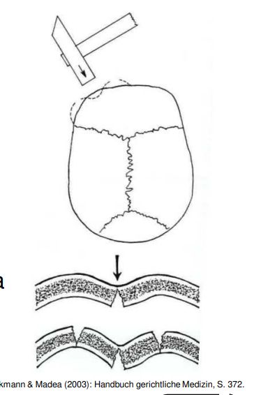 Tags #s8::Gerichtsmedizin