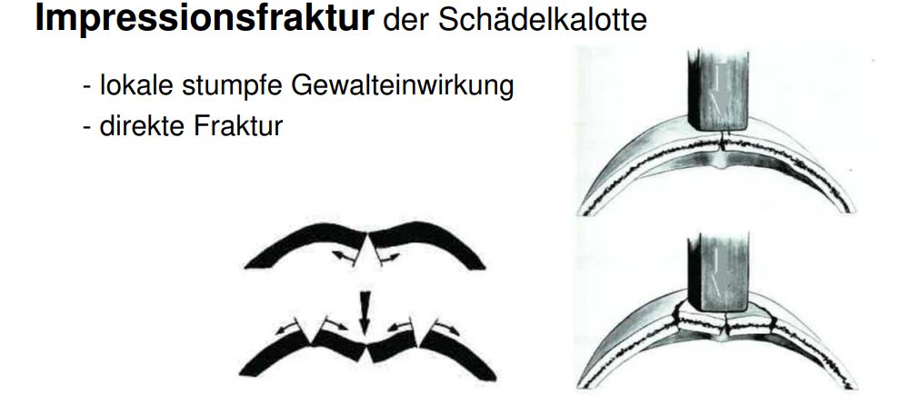 Tags #s8::Gerichtsmedizin