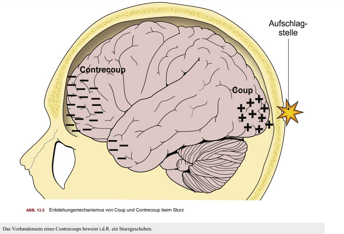 Tags #s8::Gerichtsmedizin