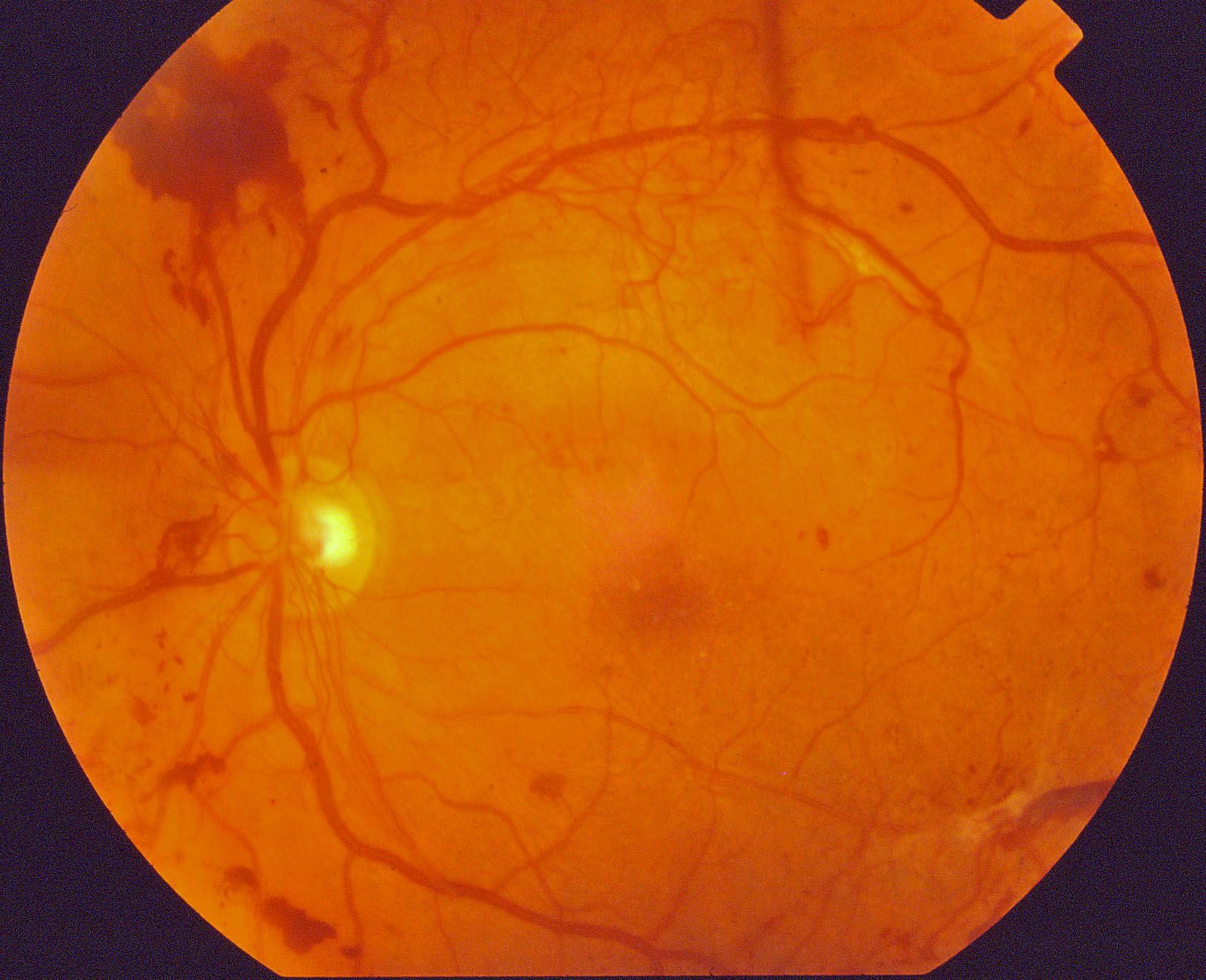 Fundus