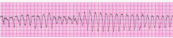 Back Polymorphic Vtac