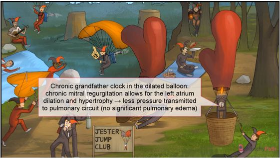 Extra Q10 Describe hemodynamic, e.g. loads, changes in chronic mitral ...