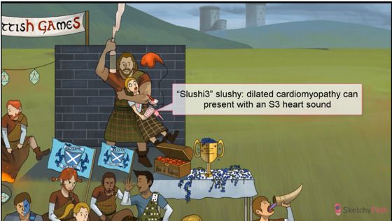 Extra Q12 Are patients with dilated cardiomyopathy at increased risk ...