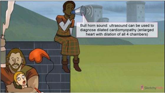 Extra Q14 Which type of heart failure (systolic or diastolic) is ...