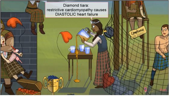 Extra Q15 PE findings (4): Restrictive Cardiomyopathy