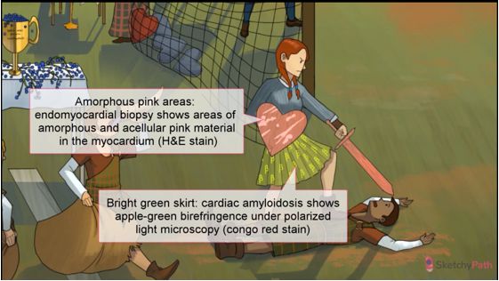 Extra Q18 What is the most common cause of restrictive cardiomypathy ...