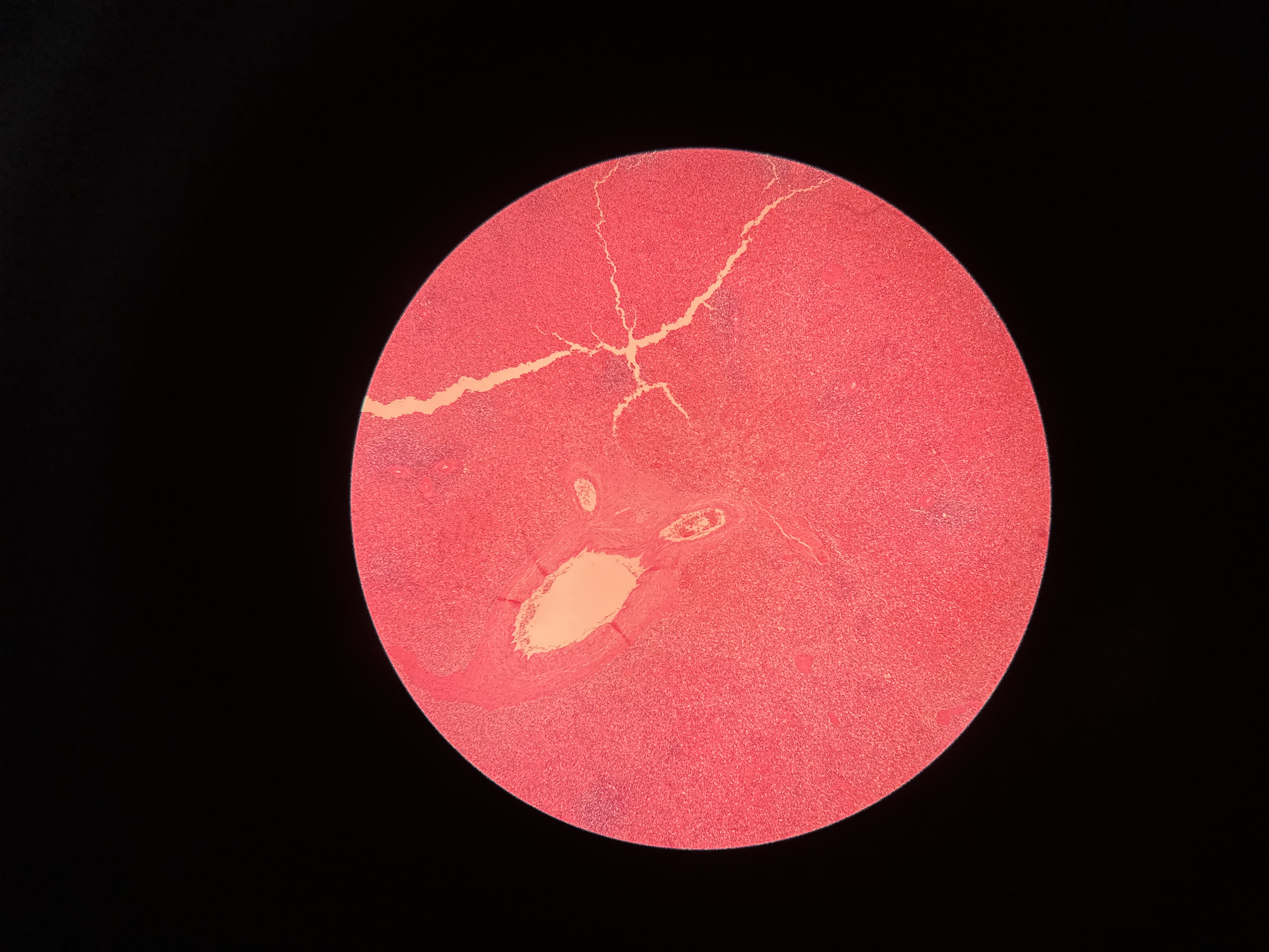 Front DIAGNOSIS:ETIOLOGY:ORGAN INVOLVED:TYPE OF INFARCTION (ACCDG TO ...