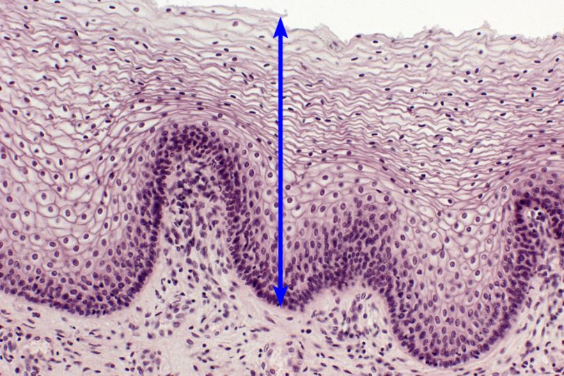 Back Stratified squamous, nonkeratinizedepitheliumImage source https ...