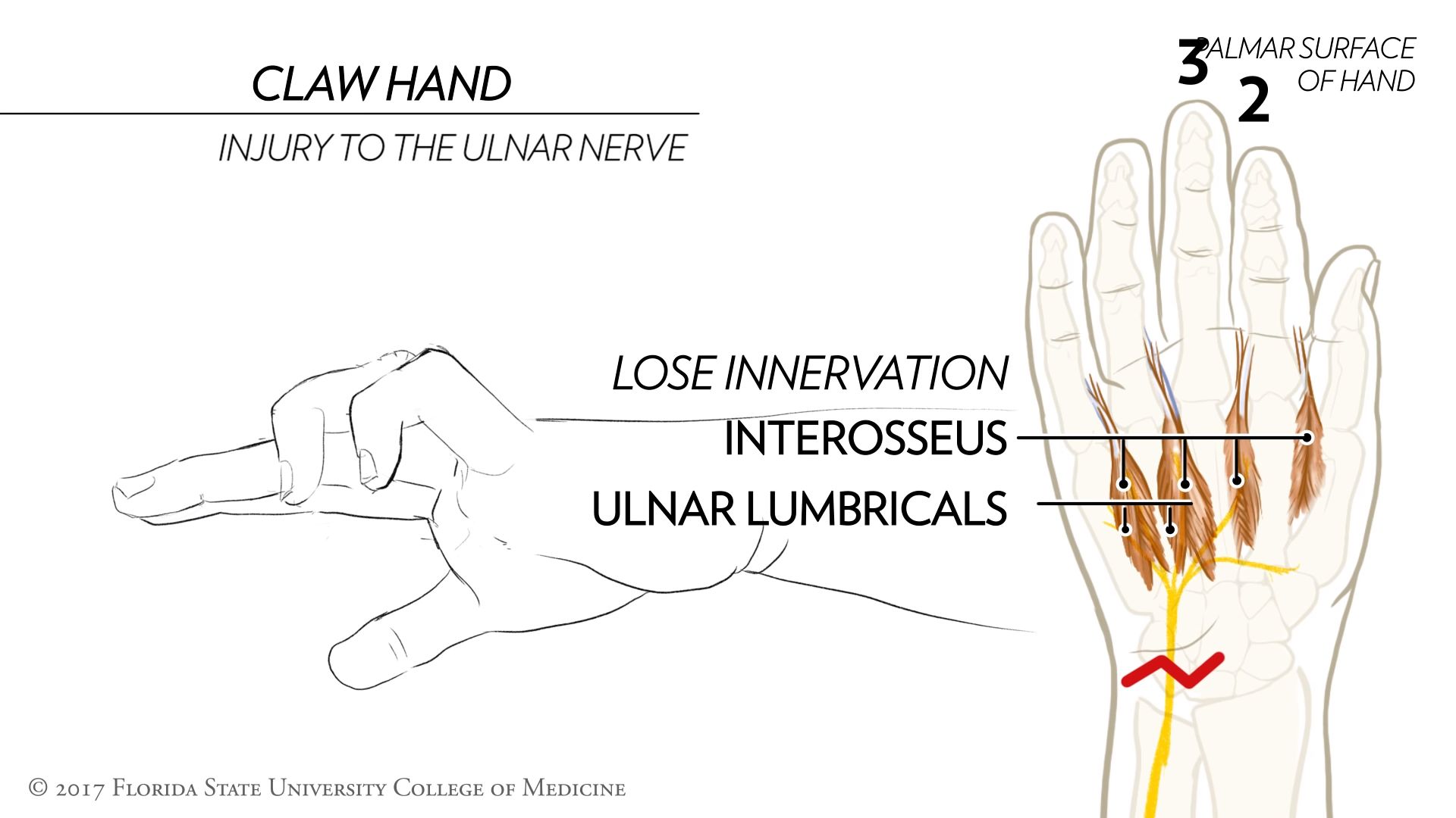 Front Muscles of the anterior thigh and innervation