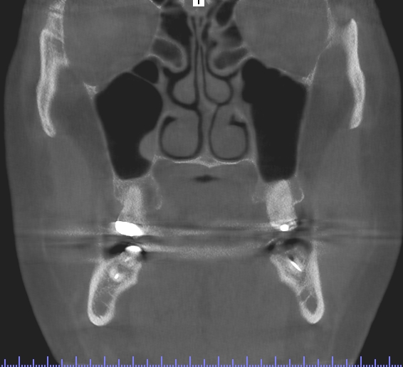Clinical Presentation